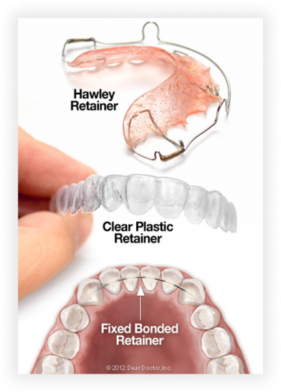 Retention - Popowich Orthodontics